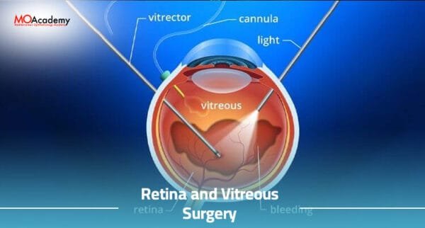 Importance of Vitreous Retinal Surgery Training - Mediterranean ...